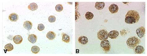Subcellular Localization Of The Pka C Subunit In Ln Lymphocytes From