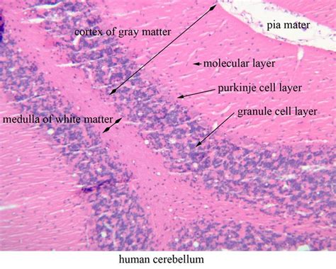 Cerebrum Microscope Slide Labeled At Cristal Justice Blog