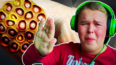 I Face My Worse Fear Trypophobia Will You Join Me Youtube
