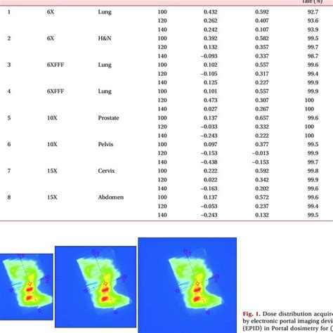 Dose Distribution Acquired By Electronic Portal Imaging Device Epid Download Scientific