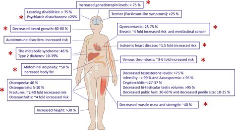 Xyy Super Male Syndrome