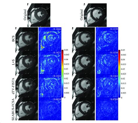 Roi Images And Error Maps Of The 7th Frame And 18th Frame Obtained By