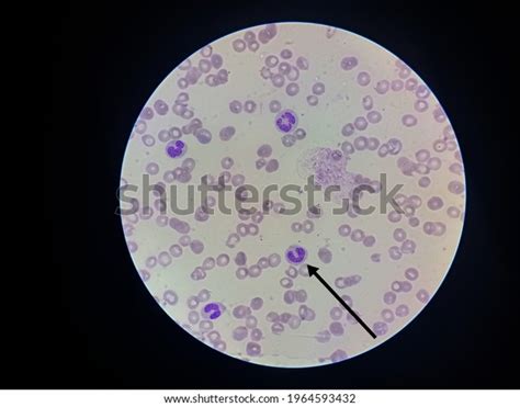 2 Cml Micro Royalty Free Photos And Stock Images Shutterstock 2 Cml Micro Royalty Free Photos And Stock Images Shutterstock