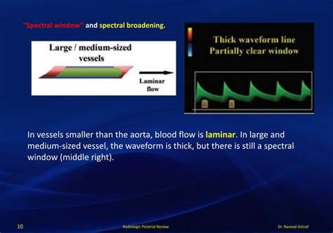Doppler Ultrasound In Peripheral Arterial Disease Pdf Heart And