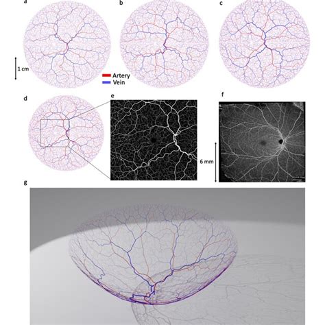 Procedural Generation Of Retinal Vasculature Using Constrained Download Scientific Diagram