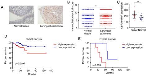 Ubr5 Regulates Proliferation And Radiosensitivity In Human Laryngeal