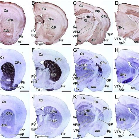 The Mrna Expression Pattern Of Wfs1 Drd1a And Drd5 In The Adult Mouse