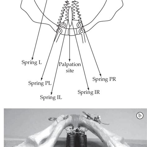 Modified Oxford Scale Employed For Digital Evaluation Of The Levator