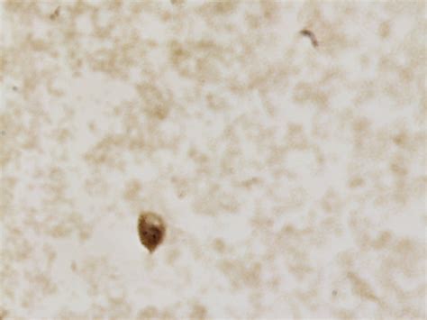 cervical cancer instance segmentation dataset by deeplearning