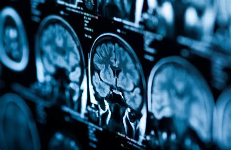 Brain And Spinal Cord Tumor Signs Know When To See A Doctor