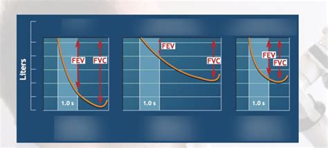 Diagram Of Standard Pulmonary Function Tests For Fev And Fvc In