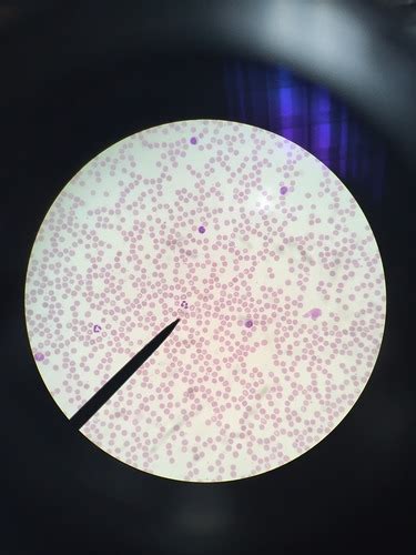 Types Of Leukocytes Flashcards Quizlet