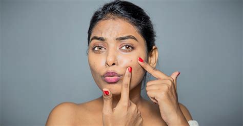 যেসব খাবার ব্রণ থেকে দূরে রাখবে
