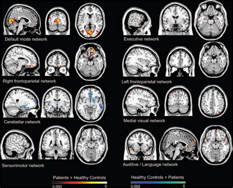Resting State Networks Which Showed Between Group Functional