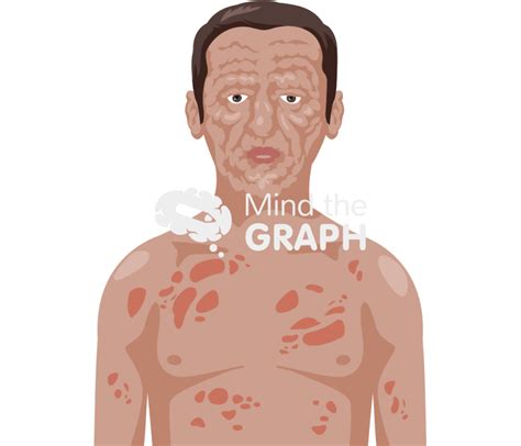 Free Leprosy Symptom Man Front Icons Symbols Pictures And Images
