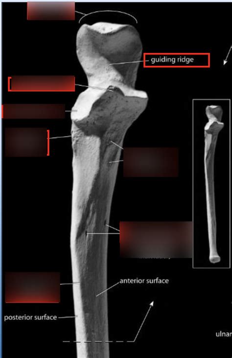 Proximal Anterior Ulna Labeling Diagram Quizlet