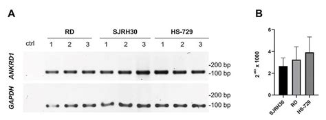 Ankyrin Repeat Domain 1 Ankrd1 Gene Expression In Human Download
