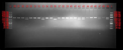 Figure 2 From Investigation Of Ppar Alpha Gene Polymorphism In Female S