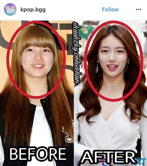 Pin By Phuong Trang On Bae Suzy Bae Suzy Plastic Surg Vrogue Co