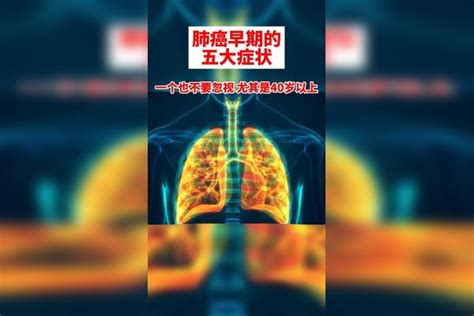 肺癌早期的这五大症状，你都中招了几个？五大症状