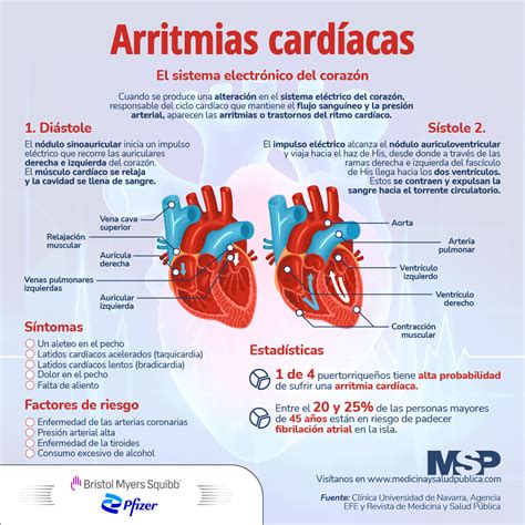 Infograf A Sobre Arritmias Cardiacas Cardiac Arrhythmias Infographic