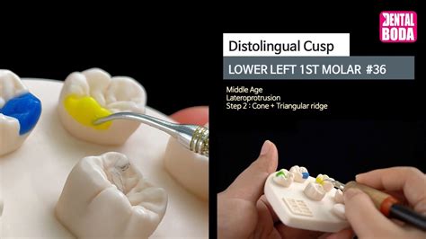 Lower Left 1st Molar Distolingual Cusp 2 Conetriangular Ridge Middle