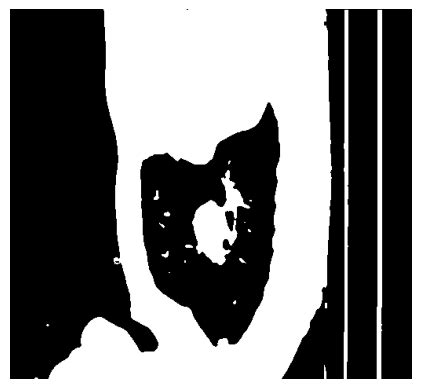 Lung Segmentation Frederik Hartmann