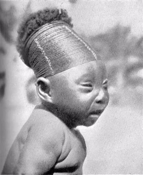 An Elongated Head Was An Ideal Of Beauty Among The Mangbetu People
