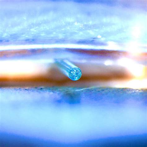 Slit Lamp Photography Of The Glaucoma Stent Placed In The Anterior