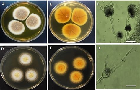Aspergillus Conidiophores Morphology
