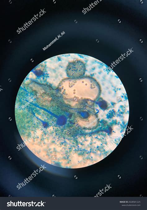Penicillium Notatum Microscope