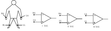 基于ads1298的心电图仪 Csdn博客