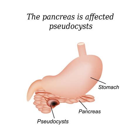 Sistema Endocrino Free Stock Vectors