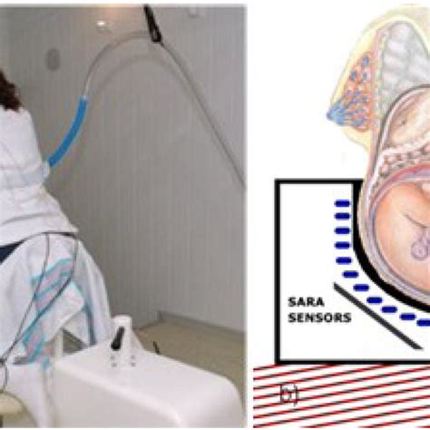 Fetal Meg System A Mother Sits On And Leans Against The Sara System