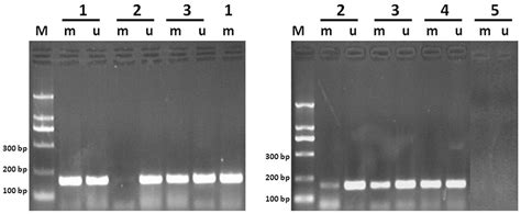 Altered Expression Of PTCH And HHIP In Gastric Cancer Through Their Gene Promoter Methylation