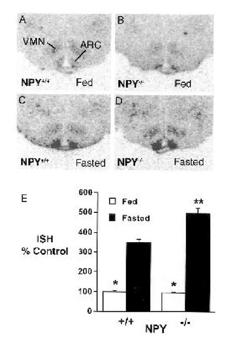 A Relative In Situ Hybridization Ish Of Total Leptin Receptor Mrna