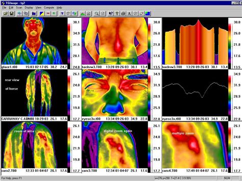 Thermreview Infrared Image Processing Software For Medical Thermal