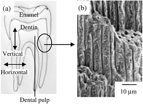 Schematic Illustration Of A Tooth A And An Sem Image Of The Tooth B
