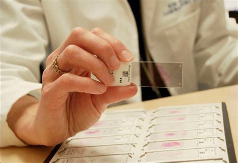 Stanford Anatomic Pathology