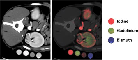 Example For Simultaneous Imaging Of Multiple Contrast Agents By Download Scientific Diagram
