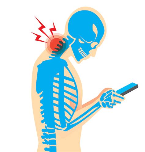 8 Easy Stretches To Manage Text Neck — Dr Sean Lamasz Chiropractor
