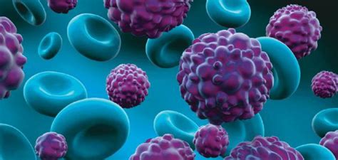 ما هي أعراض سرطان الدم سطور