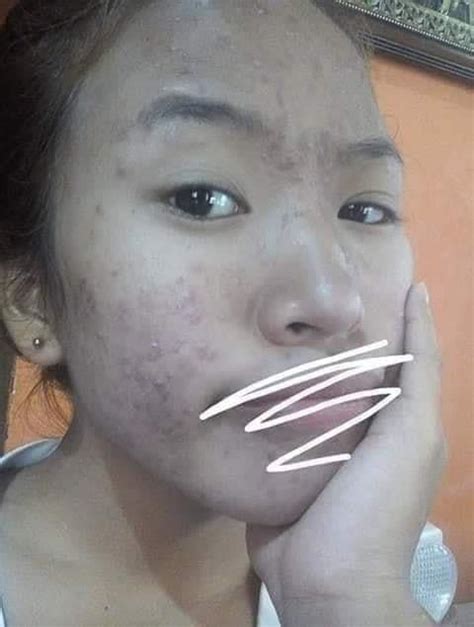 Hey Maine My Glow And Clear Journey G21 Sakura Set