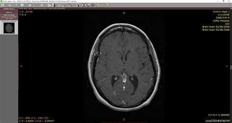 Radiant Dicom Viewer 2021 绿色版radiant Dicom Viewer绿色 Csdn博客