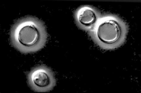 Fungos Do Reator Nuclear De Chernobyl Podem Proteger Astronautas Dos