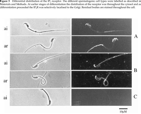 Immunofluorescence Staining Of Mouse Sperm Acrosome Intact Ai Or