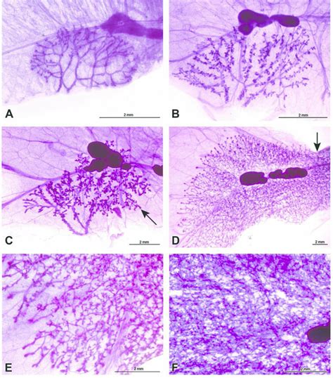 Whole Mounted Female Mammary Gland Developmental Progression From Birth