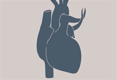 Advanced Monitoring Parameters Gedi