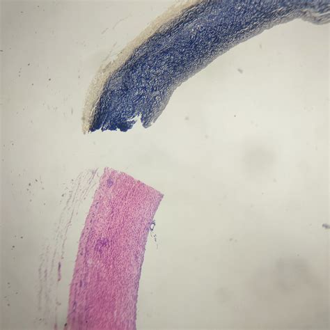 Comparison Of Artery He Stain And Elastic Fibers Stain