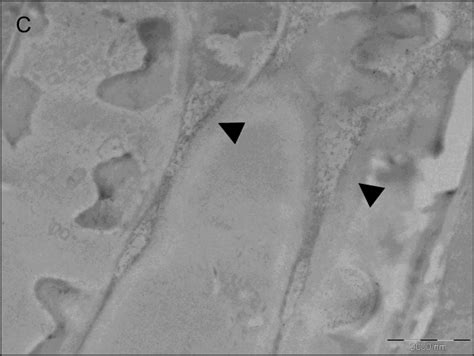 421 Analysis Of Protein Deposition Pattern In The Leaf Tissue